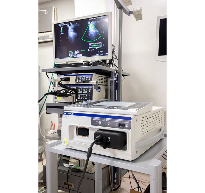manila doctors hospital s new endoscopic ultrasound